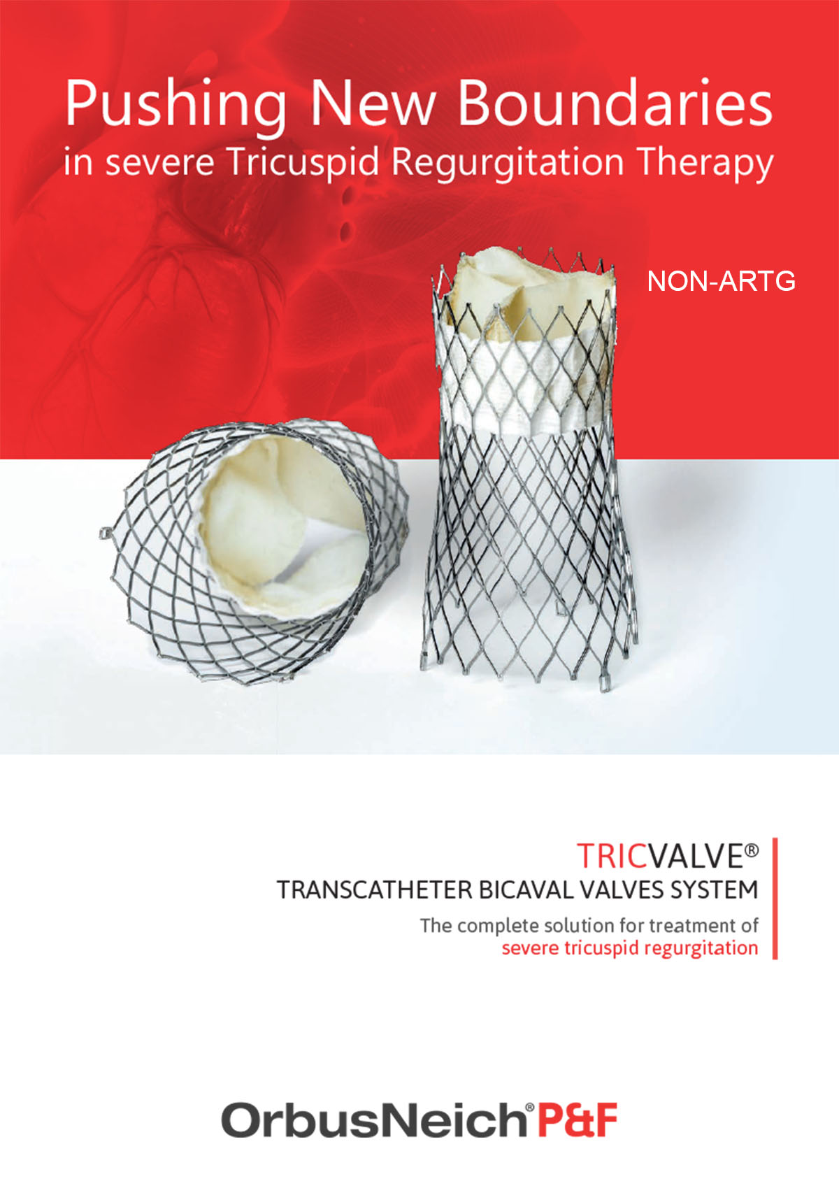 TricValve – Bio-Excel