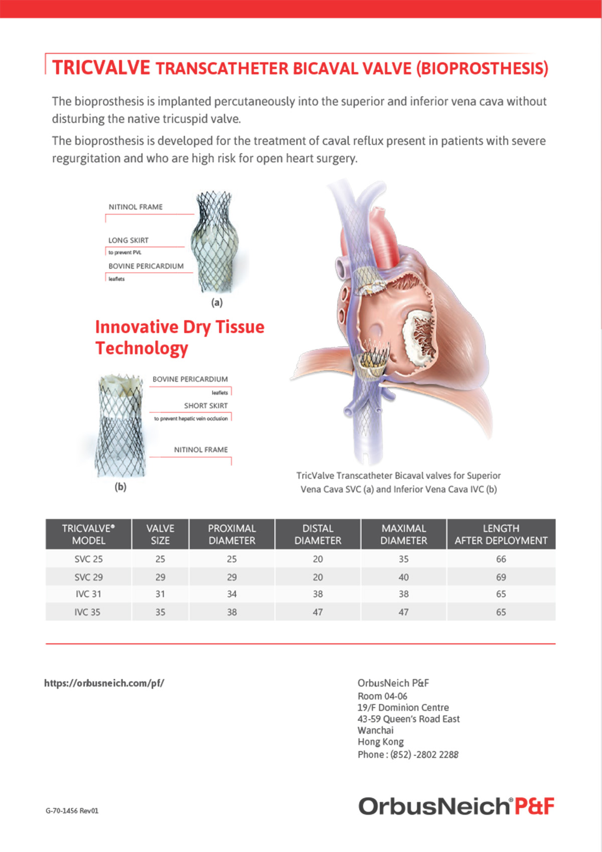 TricValve – Bio-Excel